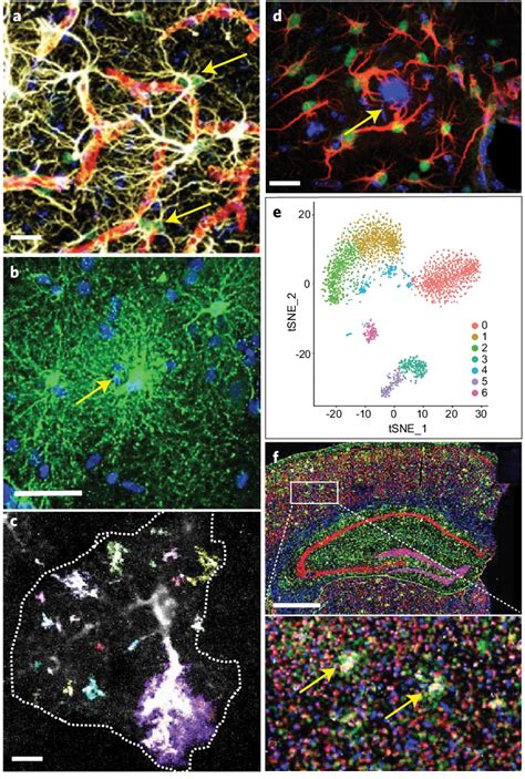 Multivariate Assessment Of Reactive Astrocytes A Reactive Astrocyte