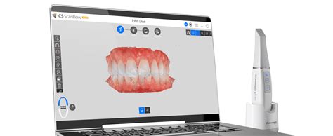 Cs 3800 Intraoral Wireless Scanner Murray Woods