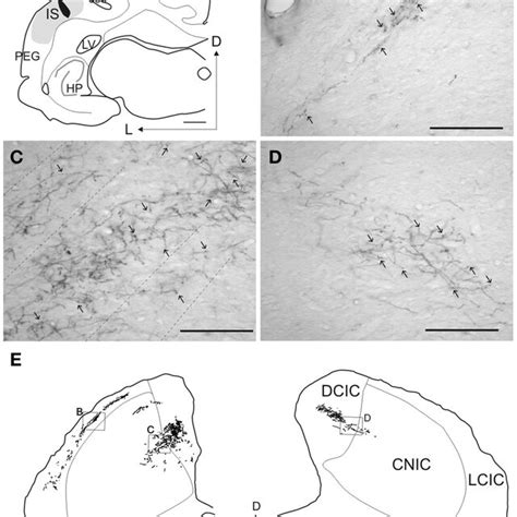 Retrogradely Labeled Cells In Ferret Auditory Cortex After Fluorescent Download Scientific