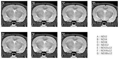 Development And Evaluation Of Deep Learning Based Reconstruction Using Preclinical 7t Magnetic
