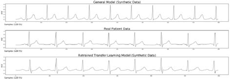 A Demonstration Of The Transfer Learning Model Download Scientific