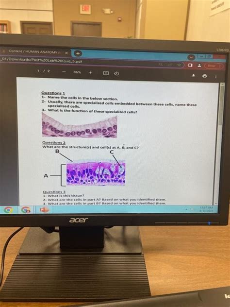 Solved Questions 1 1 Name The Cells In The Below Section
