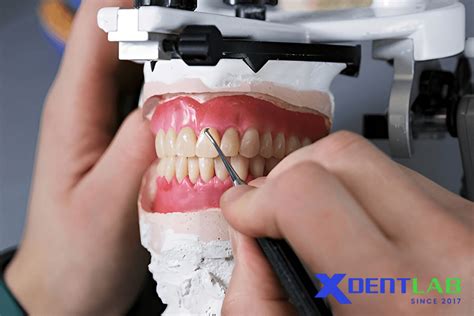 Wax Bite Block Precision For Perfect Prosthetics Xdent Lab