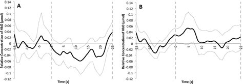 Hemodynamic Time Course For The Right Hemisphere In Response To S12