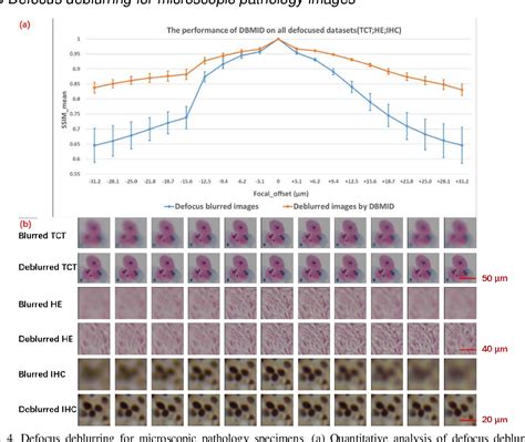Figure From Blind Deblurring For Microscopic Pathology Images Using Deep Learning Networks