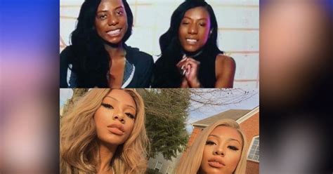 Clermont Twins Before Surgery 1