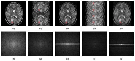 Deep Learning For Undersampled Mri Reconstruction Iopscience