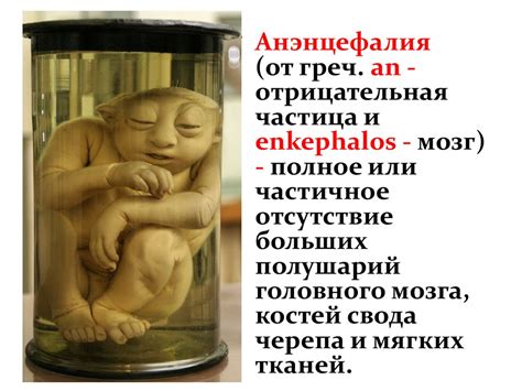 Наследственные болезни и их классификация Лекция № 5 презентация онлайн