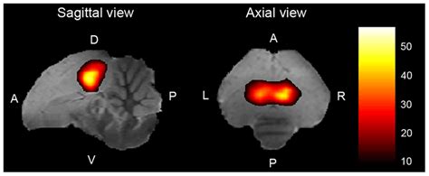 Statistical Maps Of Bold Activation Induced By All Stimuli Together