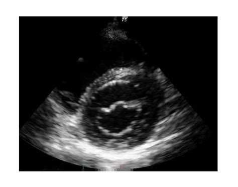 Psax Mitral Level Quiz