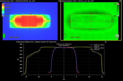 image of a delivered epid treatment verification plan top left the