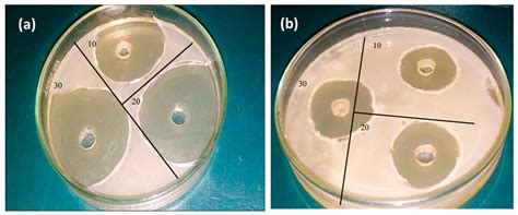 Eggshell Mediated Hematite Nanoparticles Synthesis And Their