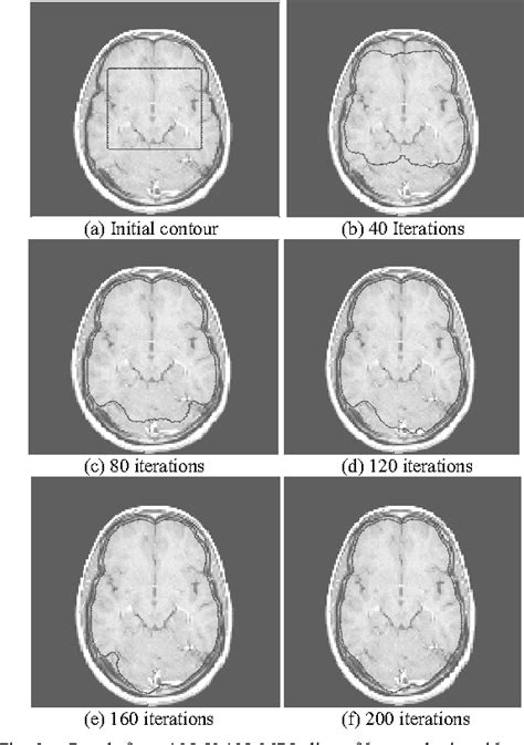 Figure 2 From A Fast Narrow Band Level Set Formulation For Shape Extraction Semantic Scholar