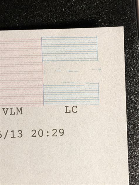 Very Strange Nozzle Check P7000 Printerknowledge Laser 3d Inkjet