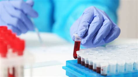 Minimal Residual Disease Testing In Multiple Myeloma Healthtree For