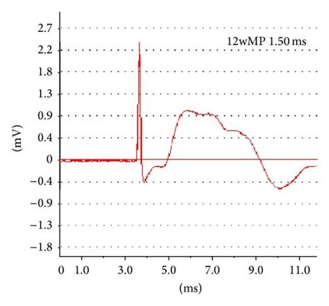 Testing Of Excitatory Signal Conduction Time In Sciatic Nerves A Download Scientific Diagram