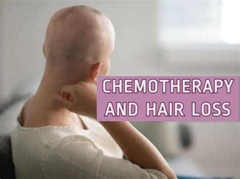 Understanding And Managing Chemotherapy Related Hair Loss