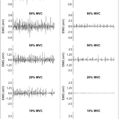 A Representative 1 S Window For Surface Emg Recordings At Chosen Force Download Scientific