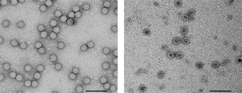 Us Now Among Countries Confirmed With Circulating Vaccine Derived