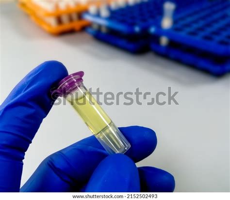 46 Csf Analysis Royalty Free Photos And Stock Images Shutterstock