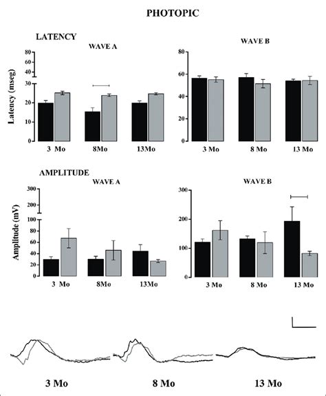 Latency And Amplitude Analysis Under Mesopic Conditions In The Upper