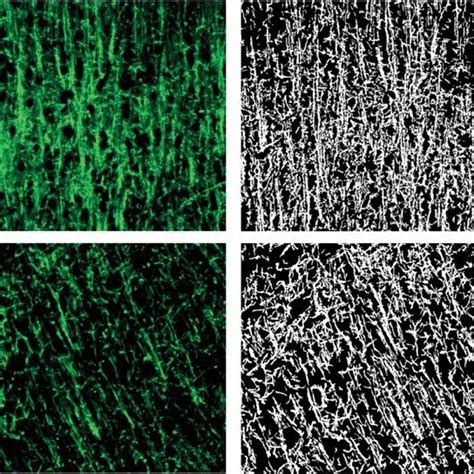 Mbp Immunodensity And Mbp Area In Rodent Models Of Neonatal Brain Download Scientific Diagram