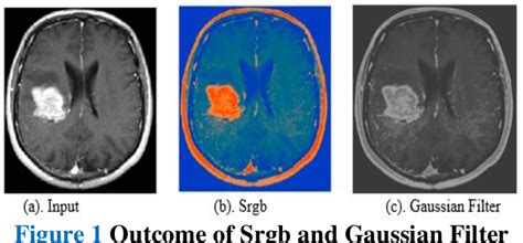 Figure 1 From The Srgb Color Space Based Density Analysis For Brain Tumor Segmentation
