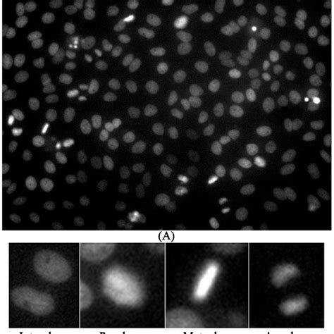 an example of blob structure hela cell nuclei detection the red