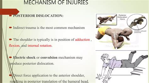 Shoulder Dislocation Pptx