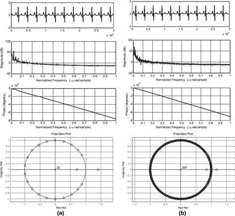 Fft And Dft Analysis Of A Normal Ecg A And A Noisy Ecg B 17 Download Scientific Diagram