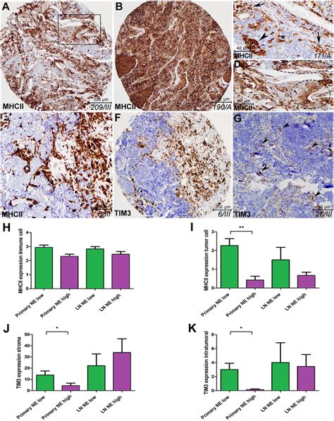Mhc Ii And Lymphocyte Exhaustion Marker Expression In Sclc Qualitative Download Scientific