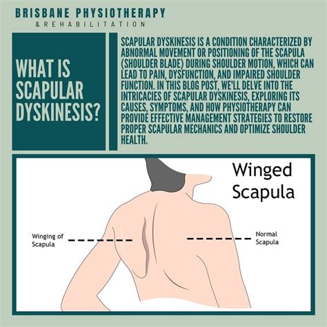 What Is Scapular Dyskinesis Brisbane Physiotherapy