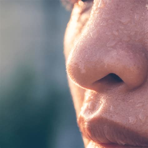 Hyperhidrosis Face Treatment Treat Excessive Face Sweat