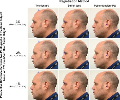 anatomical misalignments of facial photographs of the same subject in