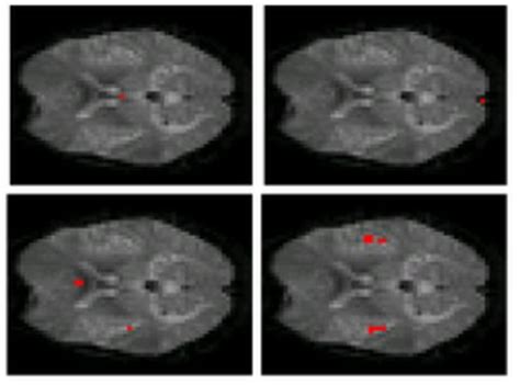 Blind Source Separation Of Fmri Images Visl