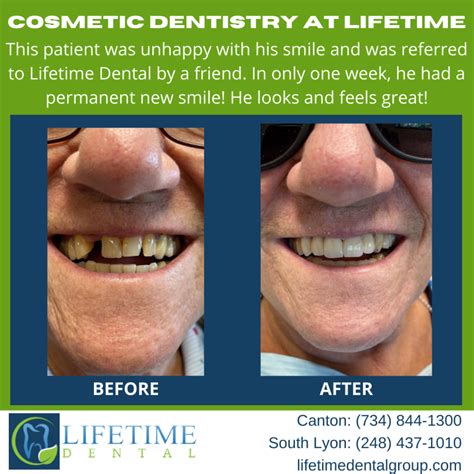 Dental Flipper Before And After Understanding Your Options For