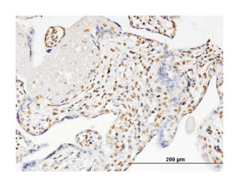 anti runx2 6e1 100ug