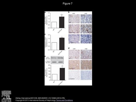 parathyroid hormone related protein protects renal tubuloepithelial