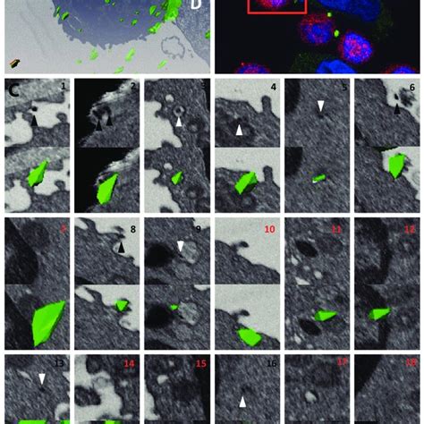 Correlation Of Fib Sem Subcellular Structures With Lscm Fluorescent Download Scientific Diagram