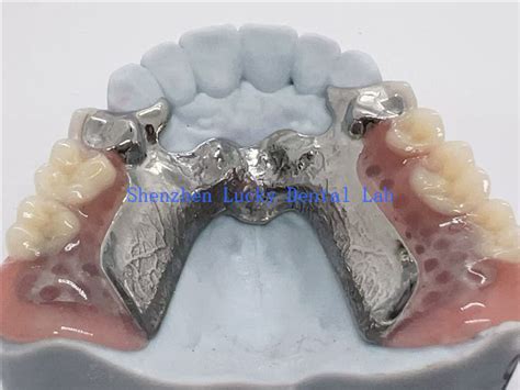 China Customized 3d Print Titanium Alloy Framework Manufacturers China Customized 3d Print Titanium Alloy Framework Manufacturers