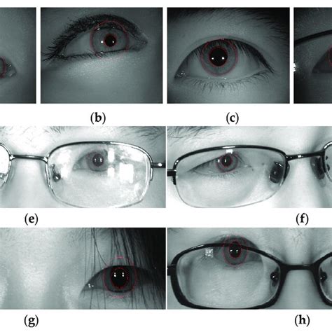 inner and outer boundaries of iris localization by improved operators