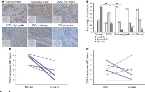Figure from The TGF β signaling pathway has a complex role in regulating mammary