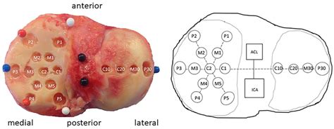 Systematic Placement Of Biopsy Locations Across The Tibia Plateau Download Scientific Diagram