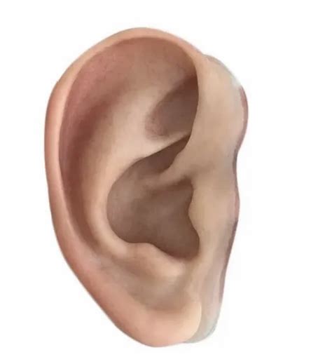 Cosmetic Silicone Ear Prosthesis Cable Operated At ₹ 16000 In Hyderabad