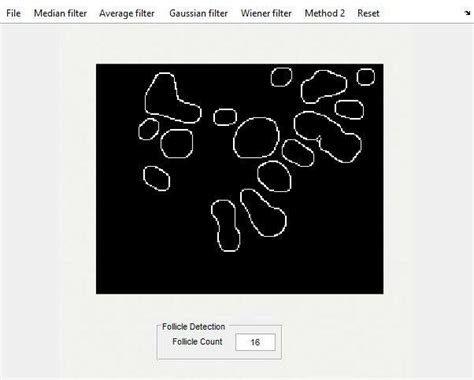 the result of follicle calculation in matlab gui application download