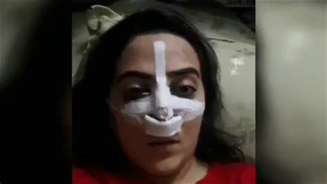 نمونه رضایت بیمار از نتیجه عمل بینی توسط دکتر الهام یعقوبی نماشا