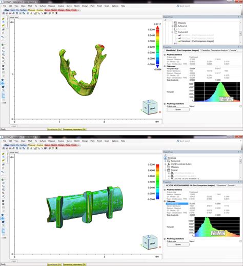 STL Files Superimposition And Comparison The Alignment Of STL Files Of Download Scientific