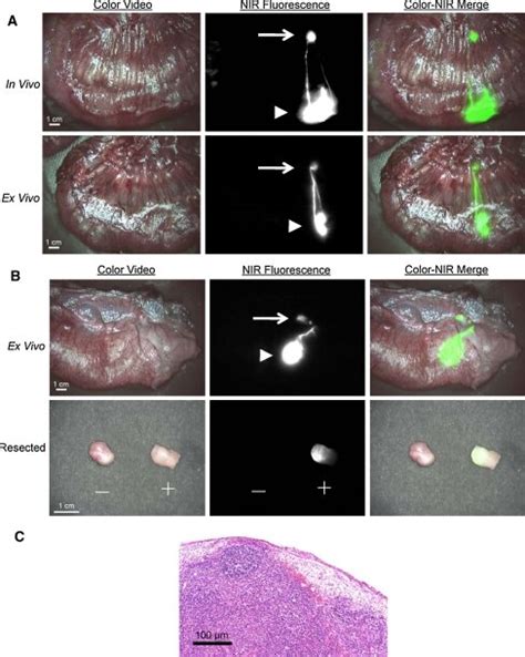 In Vivo And Ex Vivo Sln Mapping In Colon And Rectum A Identification Download Scientific