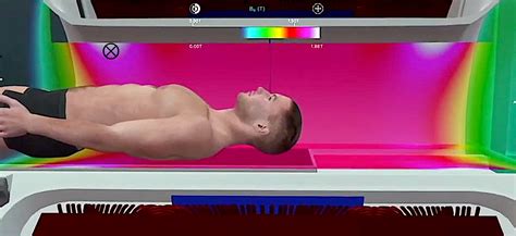 Spatial Gradient Field Questions And Answers In Mri