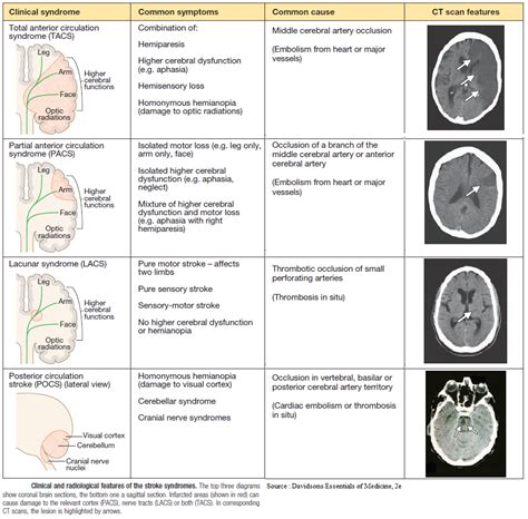 🔶 Clinical And Radiological Features Manual Of Medicine Facebook